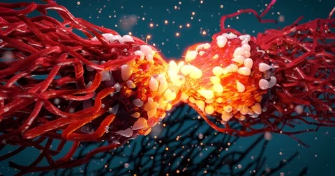 Cancer In T Stock Videos – Royalty-Free HD & 4K Videos