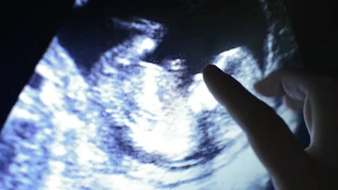 doctor analyzing blue mri scan of a baby... | Stock Video | Pond5