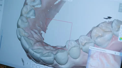 Doctor, dentist makes a 3D scan of the t... | Stock Video | Pond5