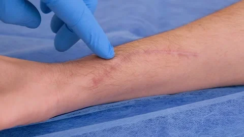 The doctor examines the scar of the male... | Stock Video | Pond5