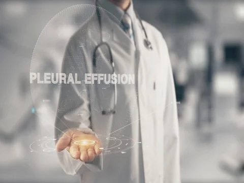 Doctor holding in hand Pleural Effusion | Stock Video | Pond5