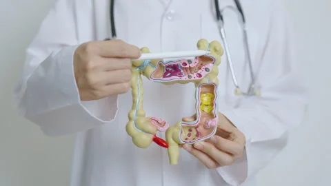 Doctor with human Colon anatomy model an... | Stock Video | Pond5