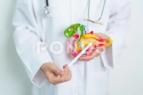 Doctor with human Pancreatitis anatomy model with Pancreas, Gallbladder ...