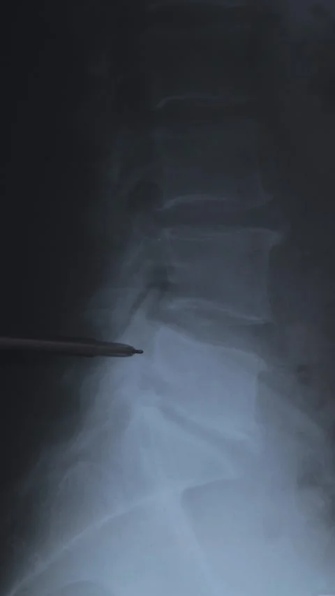 Doctor learn vertical X-ray scan of inte... | Stock Video | Pond5