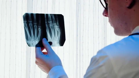 Hand Fingers Acehing Stock Videos – Royalty-Free HD & 4K Videos