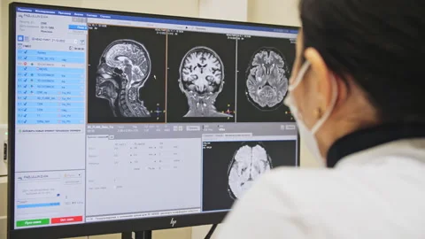 Doctor with mask controls MRI scanning i... | Stock Video | Pond5