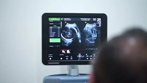 Pregnant Operating Stock Videos – Royalty-Free HD & 4K Videos | Pond5