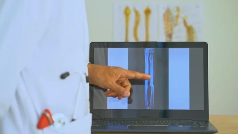 Bone Pointing Stock Video Footage | Royalty Free Bone Pointing Videos ...