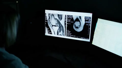 Doctor radiologist working at a computer... | Stock Video | Pond5