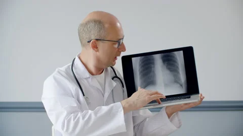 Doctor showing laptop with x-ray image o... | Stock Video | Pond5