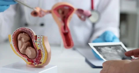 The doctor shows the model of the uterus... | Stock Video | Pond5