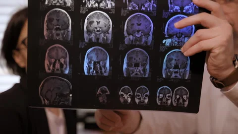 Doctors analyze a patient's MRI scan tog... | Stock Video | Pond5