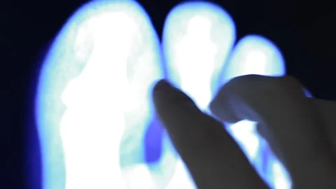 doctor's hand analyzing blue x-ray scan ... | Stock Video | Pond5
