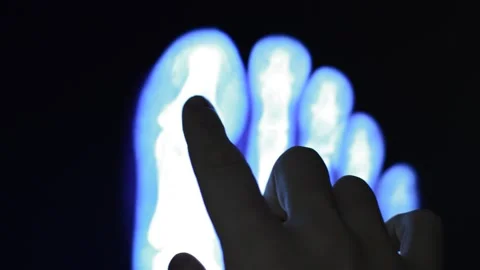 doctor's hand analyzing blue x-ray scan ... | Stock Video | Pond5