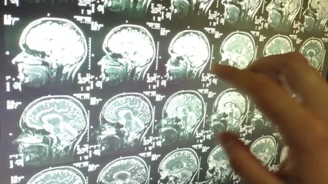 doctor's hand analyzing human brain blue... | Stock Video | Pond5