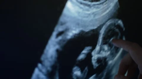 doctor's hand analyzing mri scan of a fe... | Stock Video | Pond5