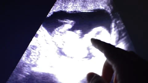 doctor's hand watch a mri scan of a baby... | Stock Video | Pond5
