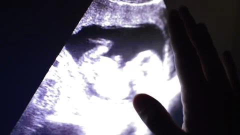 doctor's hand watch a mri scan of a baby... | Stock Video | Pond5