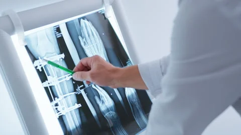 Doctors point to x-ray medical imaging w... | Stock Video | Pond5
