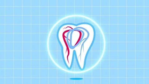 Drawn teeth, 2D animation. Dental treatm... | Stock Video | Pond5