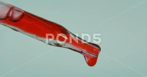 Photograph: A drop of blood drips from the pipette. Blood for injection ...