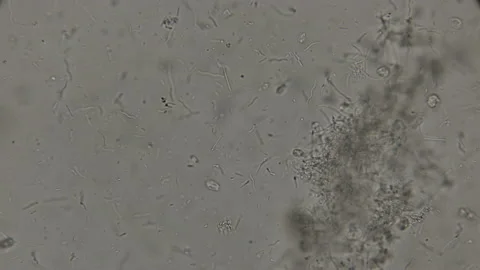 Dirty Drop Of Water Under A Microscope Stock Videos – Royalty-Free HD ...