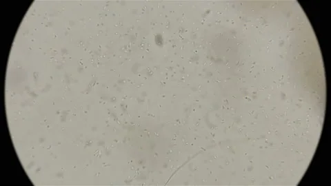 Dirty Drop Of Water Under A Microscope Stock Videos – Royalty-Free HD ...