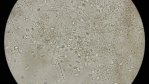 Dirty Drop Of Water Under A Microscope Stock Videos – Royalty-Free HD ...