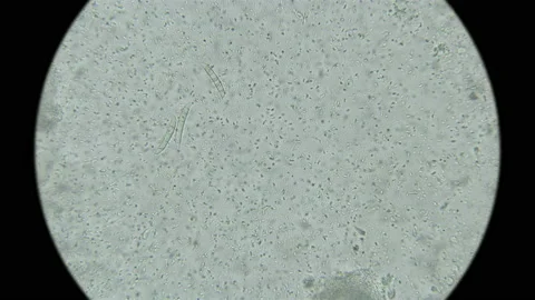 Dirty Drop Of Water Under A Microscope Stock Videos – Royalty-Free HD ...