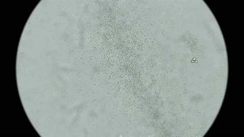 Dirty Drop Of Water Under A Microscope Stock Videos – Royalty-Free HD ...