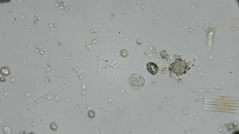 Dirty Drop Of Water Under A Microscope Stock Videos – Royalty-Free HD ...