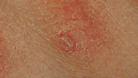 Dry Skin E Stock Videos – Royalty-Free HD & 4K Videos