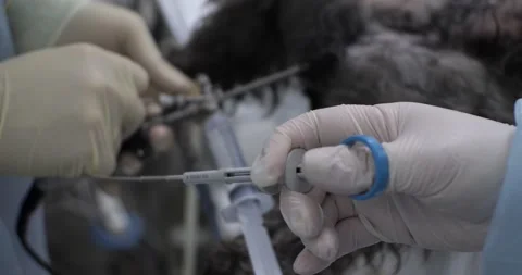 During cystoscopy of the bladder, the as... | Stock Video | Pond5