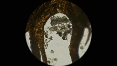 dust, water mite under a microscope | Stock Video | Pond5