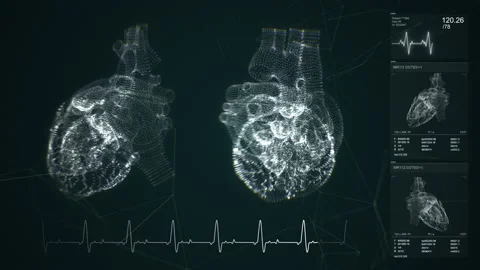 Dynamic pulsating heart. MRI scanning. H... | Stock Video | Pond5