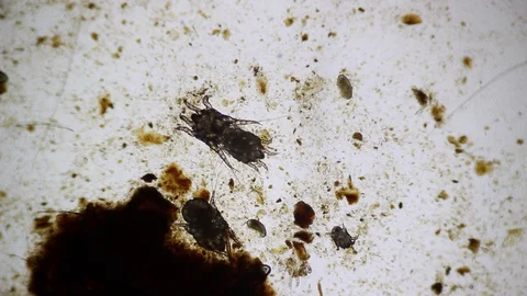 ear mite under microscope | Stock Video | Pond5