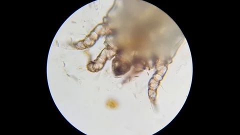 ear mite under microscope | Stock Video | Pond5