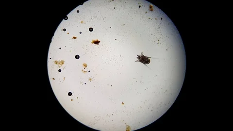 ear mite under microscope | Stock Video | Pond5