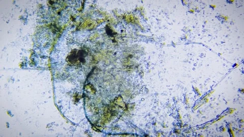 Earwax Stock Footage ~ Royalty Free Stock Videos | Pond5