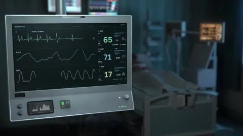 ECG Device Displays Life Signs Of Patien... | Stock Video | Pond5