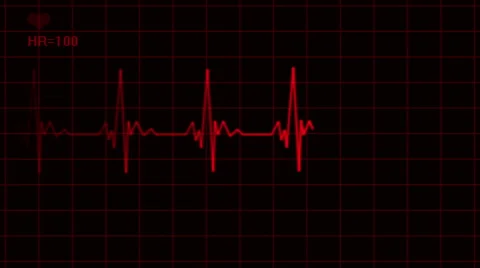 ECG EKG Electrocardiogram Monitor Normal... | Stock Video | Pond5