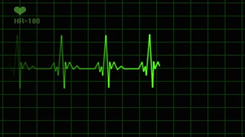 ECG EKG Electrocardiogram Monitor Normal... | Stock Video | Pond5