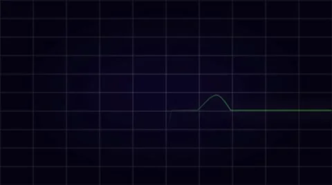 ECG / EKG Heart Monitor Normal Sinus Rhy... | Stock Video | Pond5