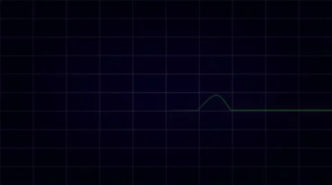 ECG / EKG Heart Monitor Normal Sinus Rhy... | Stock Video | Pond5