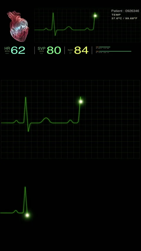 ECG Heart Beat Line Simulation | Stock Video | Pond5