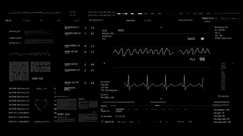 ECG heart rate monitor. Medical UI HUD. ... | Stock Video | Pond5