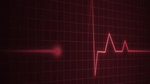 Electrocardiogram Background Stock Video Footage | Royalty Free ...