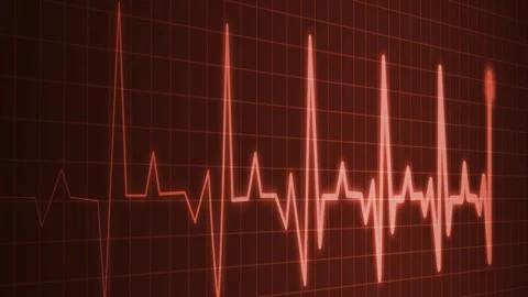 ECG Heartbeat Waveform Animated, Electro... | Stock Video | Pond5