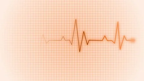 Electrocardiogram Background Stock Video Footage | Royalty Free ...