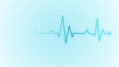 ECG Heartbeat Waveform on Grid Backgroun... | Stock Video | Pond5